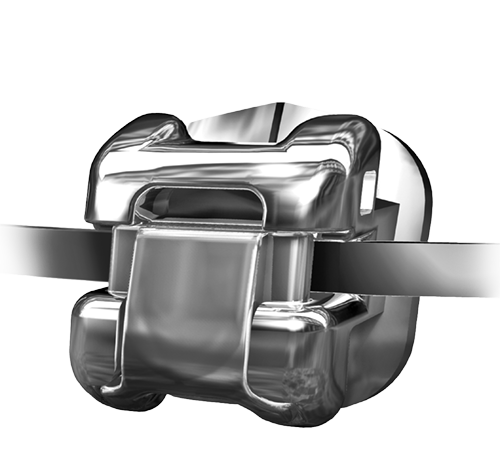 Damon Braces for Faster Treatment and Customized Orthodontic Solutions